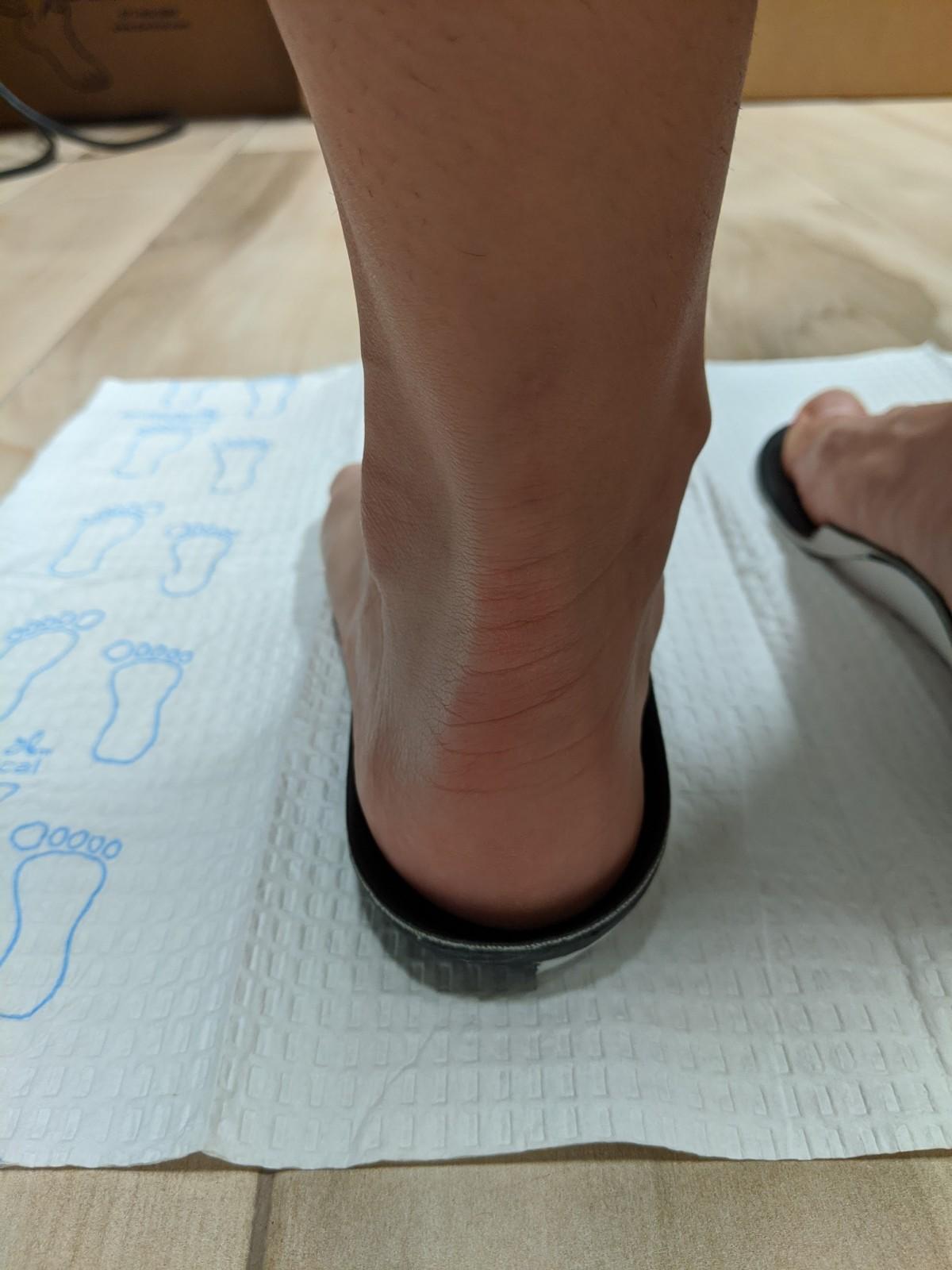 Orthotics and Shoe Inserts – GoldenFeet Podiatry