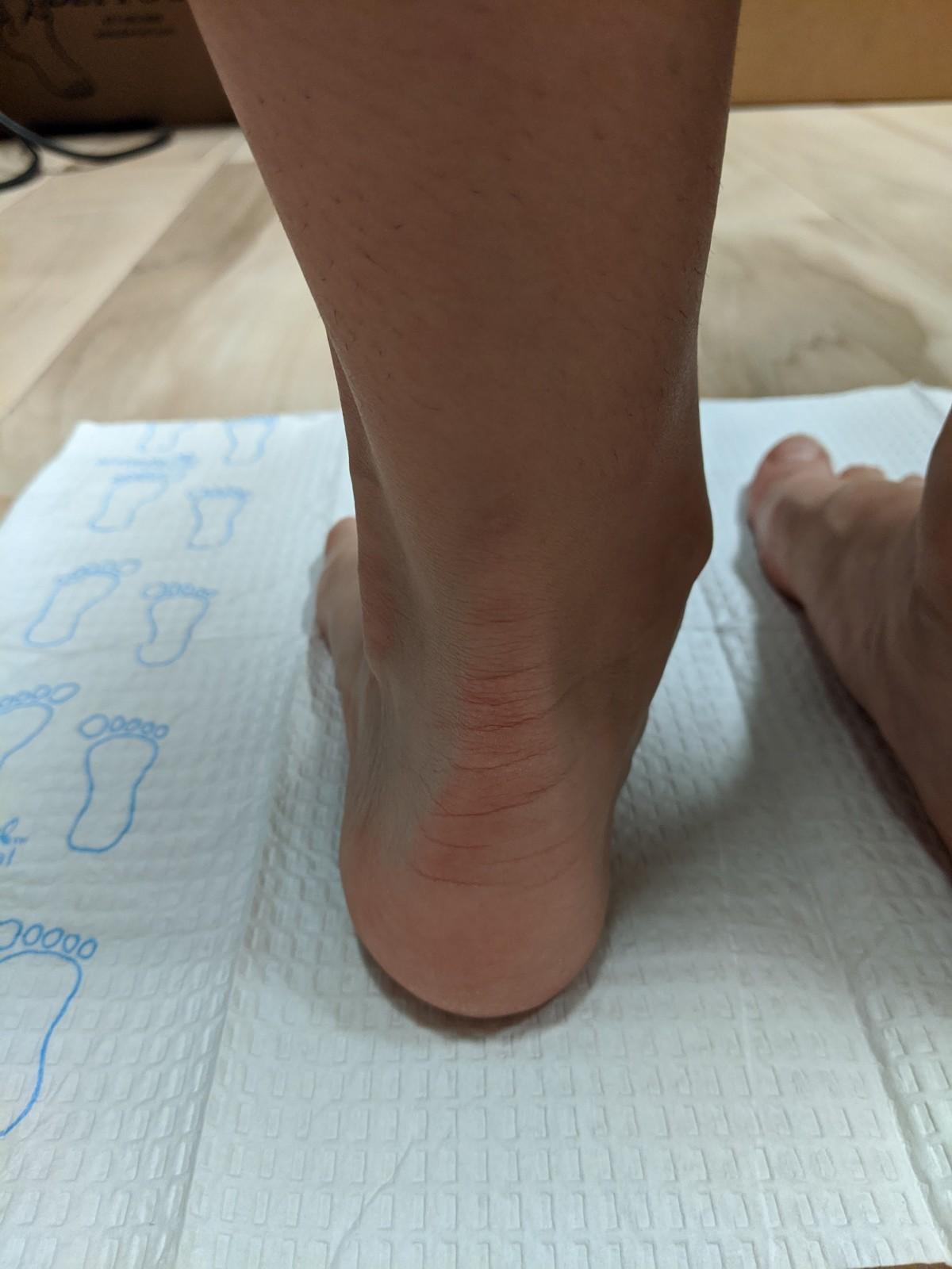 Orthotics and Shoe Inserts – GoldenFeet Podiatry